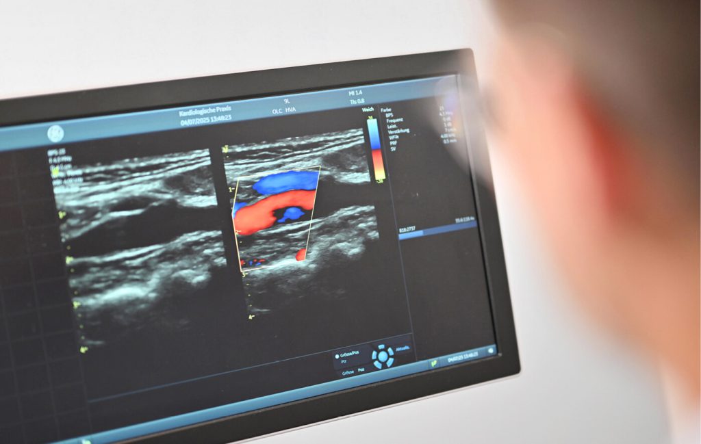 Duplexsonographie der Arm- und Beinarterien - Kardiologische Praxis